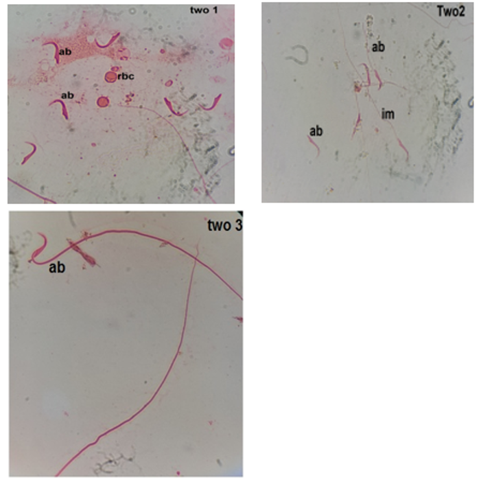 Acta Scientific | International Open Library | Journals Publishing Group